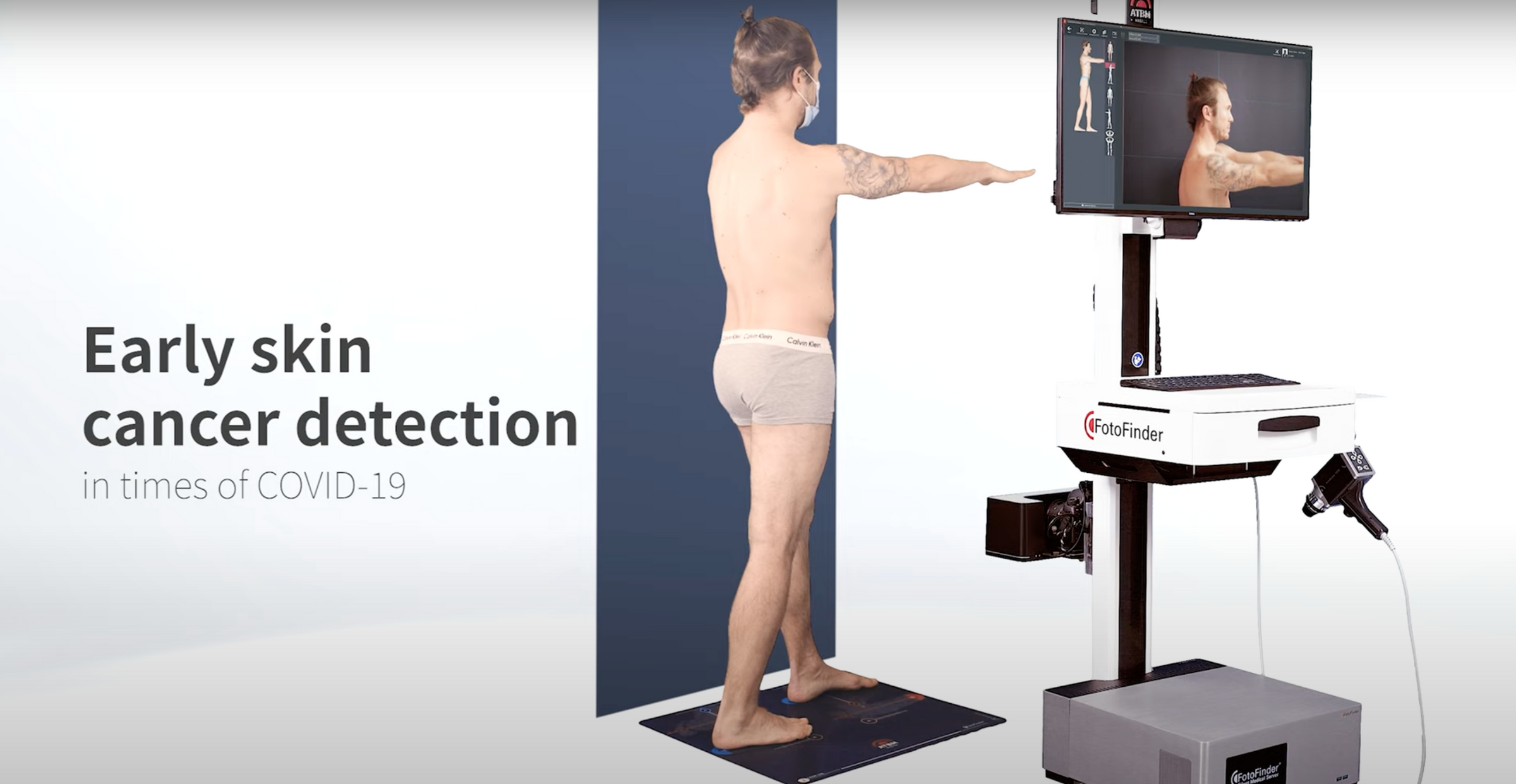 FotoFinder ATBM Master – Schuco