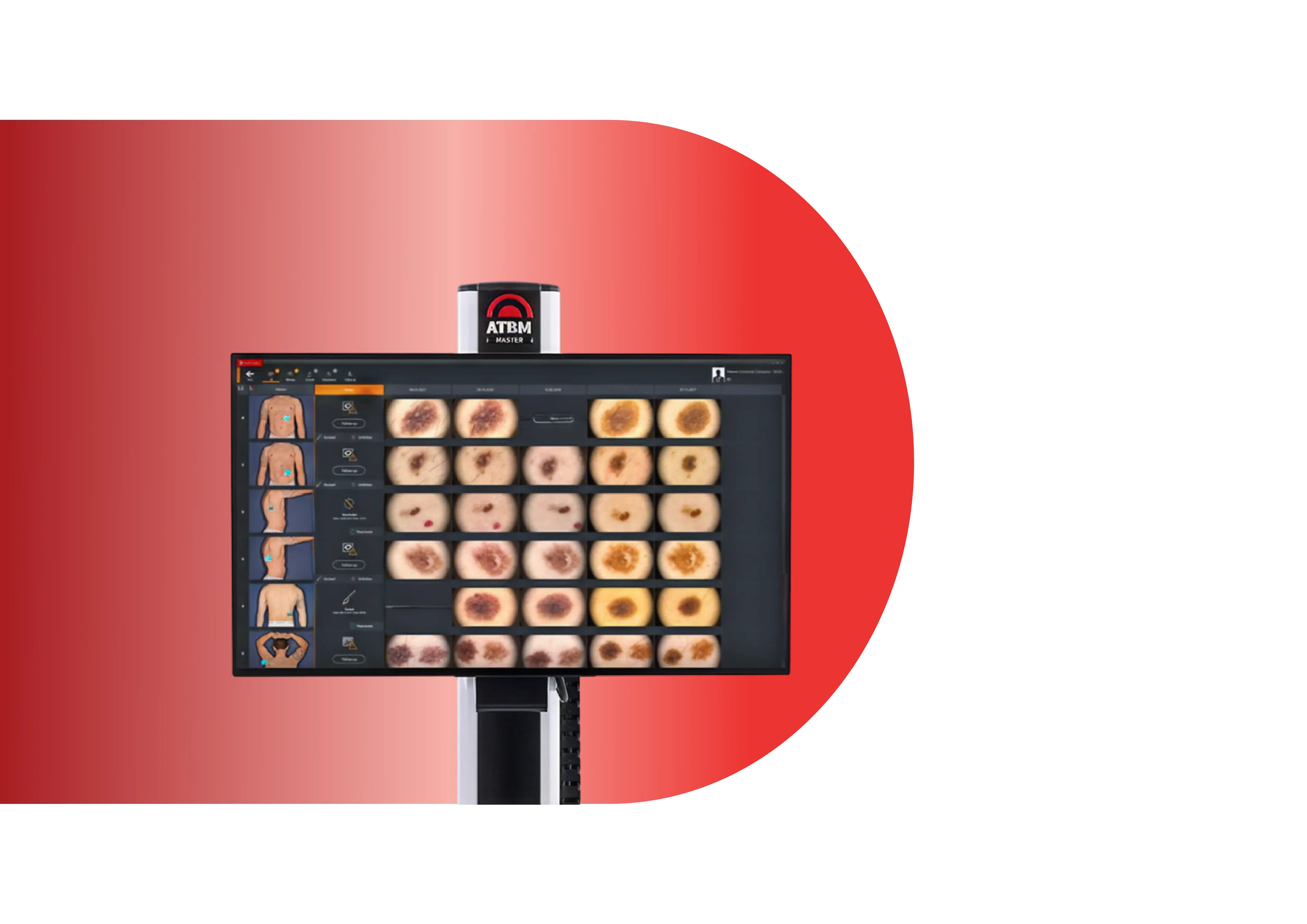 FotoFinder ATBM Learn More – Schuco