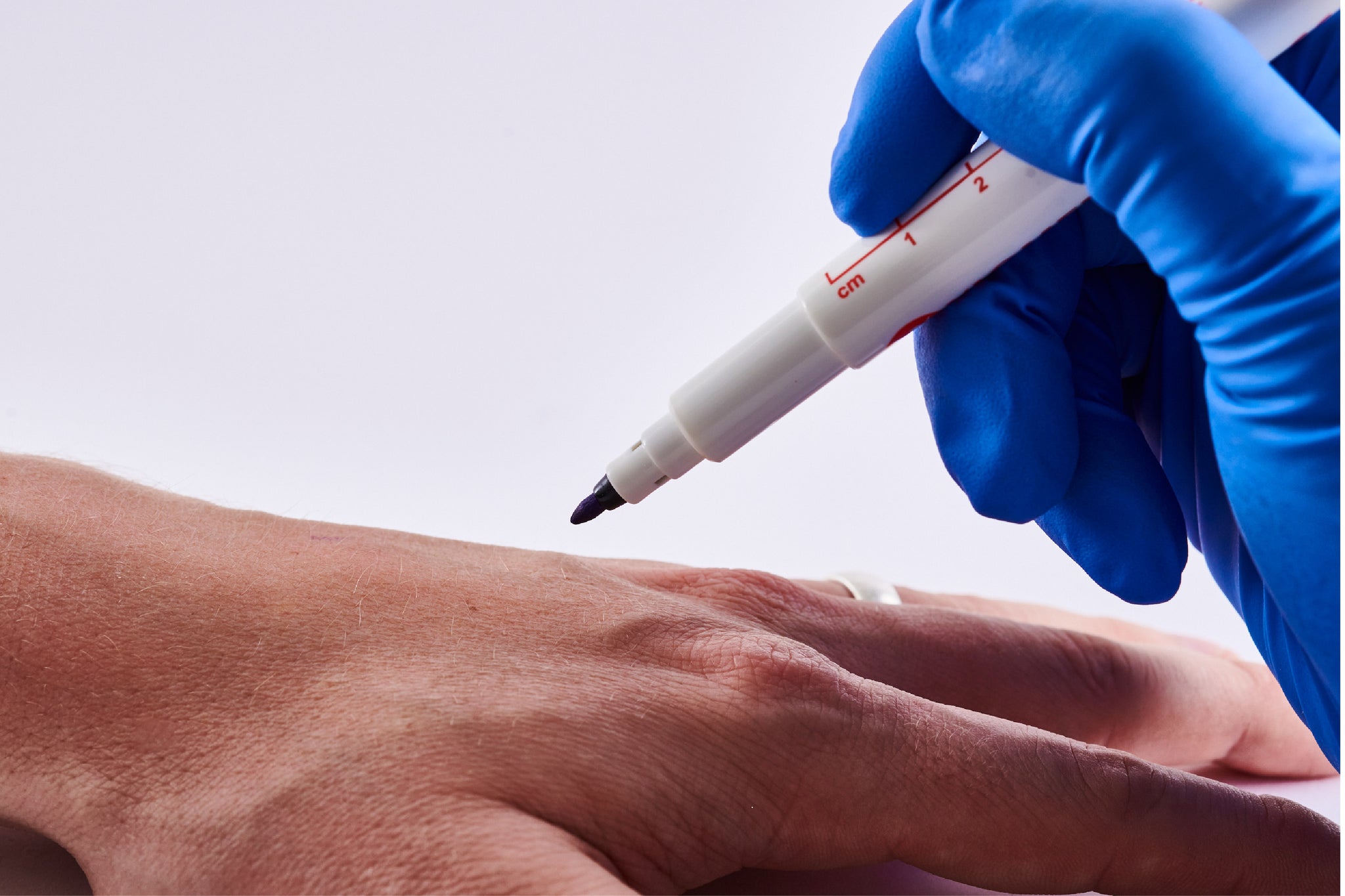 Surgical Skin Marker Pens – Schuco